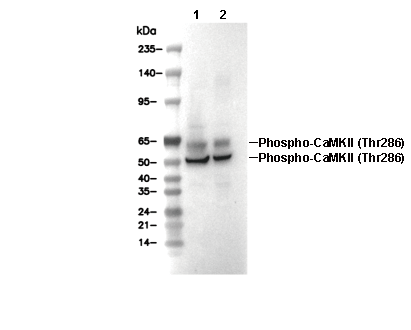 Phospho-CaMKII (Thr286) Rabbit mAb | 一次抗体