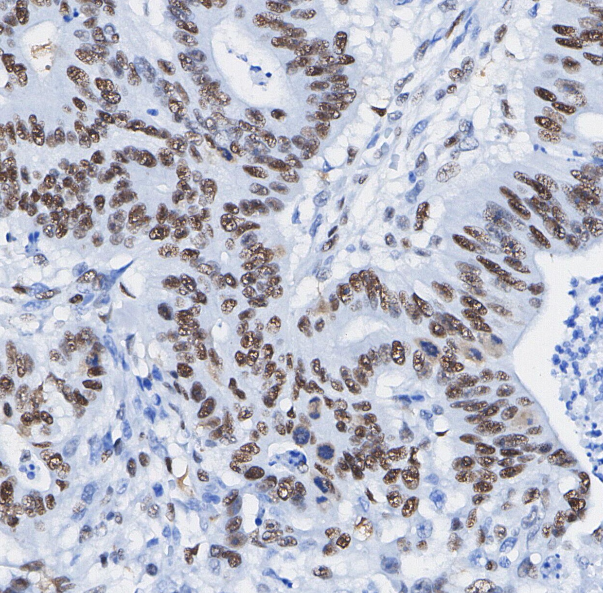 Anti-Nucleolin Rabbit Antibody [B10J2] | 一次抗体