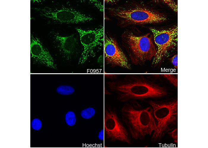 Anti-Poly/Mono-ADP Ribose Rabbit Antibody [A22J18] | 一次抗体