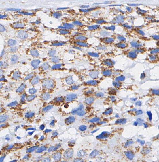 Nuclear Pore Complex Proteins Mouse mAb | 一次抗体