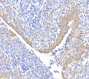 S100A9 + Calprotectin (S100A8/A9 complex) Antibody [P14P6]