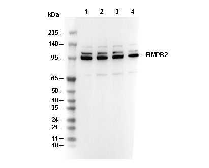 BMPR2 Antibody [P22A5]