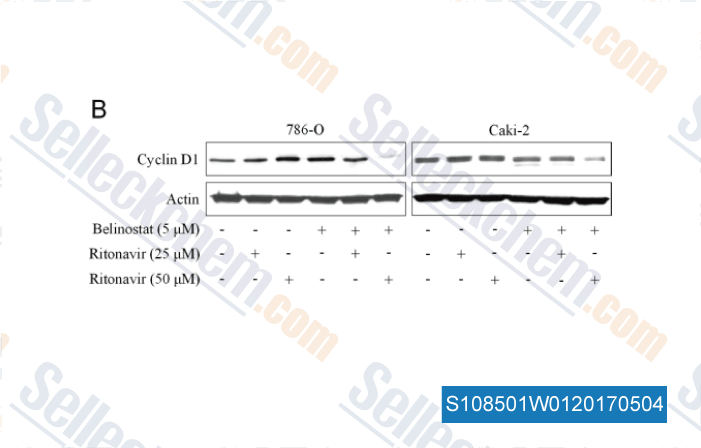 Belinostat (PXD101) | HDAC 阻害剤